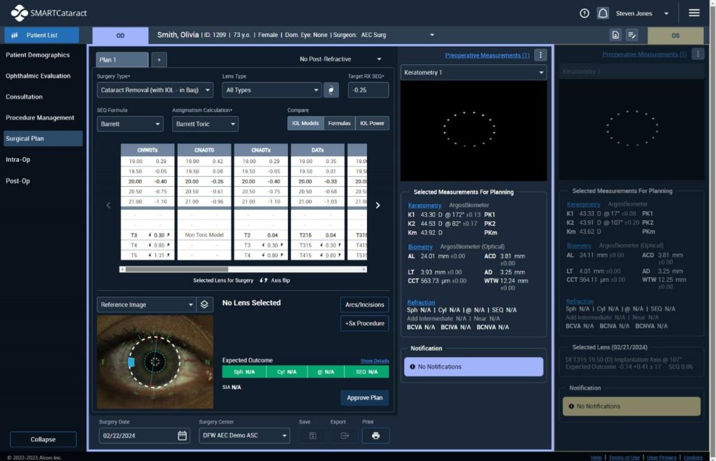 SMARTCataract: Improving the Workflow with Refractive Cataract Surgery ...
